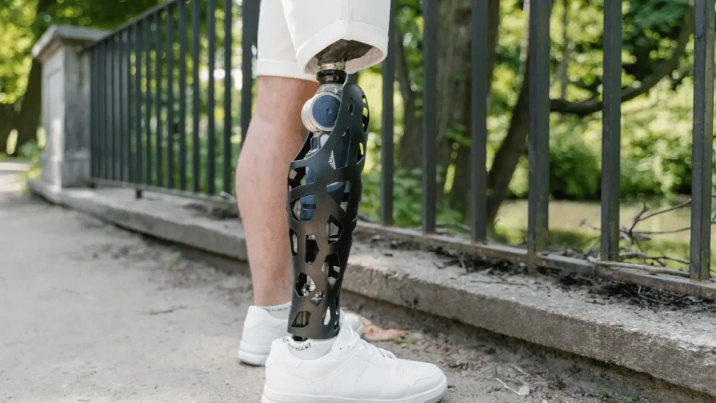 Amputação no trabalho? Conheça seus 11 direitos